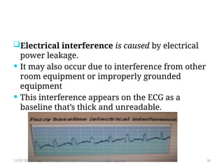 Basic Electrocardiography (ECG) interpretation | PPTX