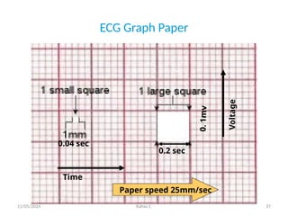 Basic Electrocardiography (ECG) interpretation | PPTX