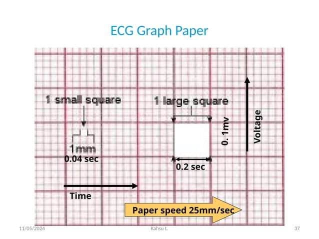 Basic Electrocardiography (ECG) interpretation | PPTX | Heart and ...