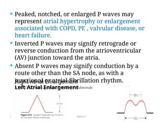 Basic Electrocardiography (ECG) interpretation | PPTX