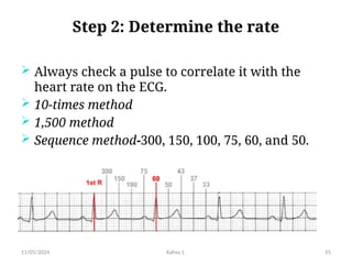 Basic Electrocardiography (ECG) interpretation | PPTX