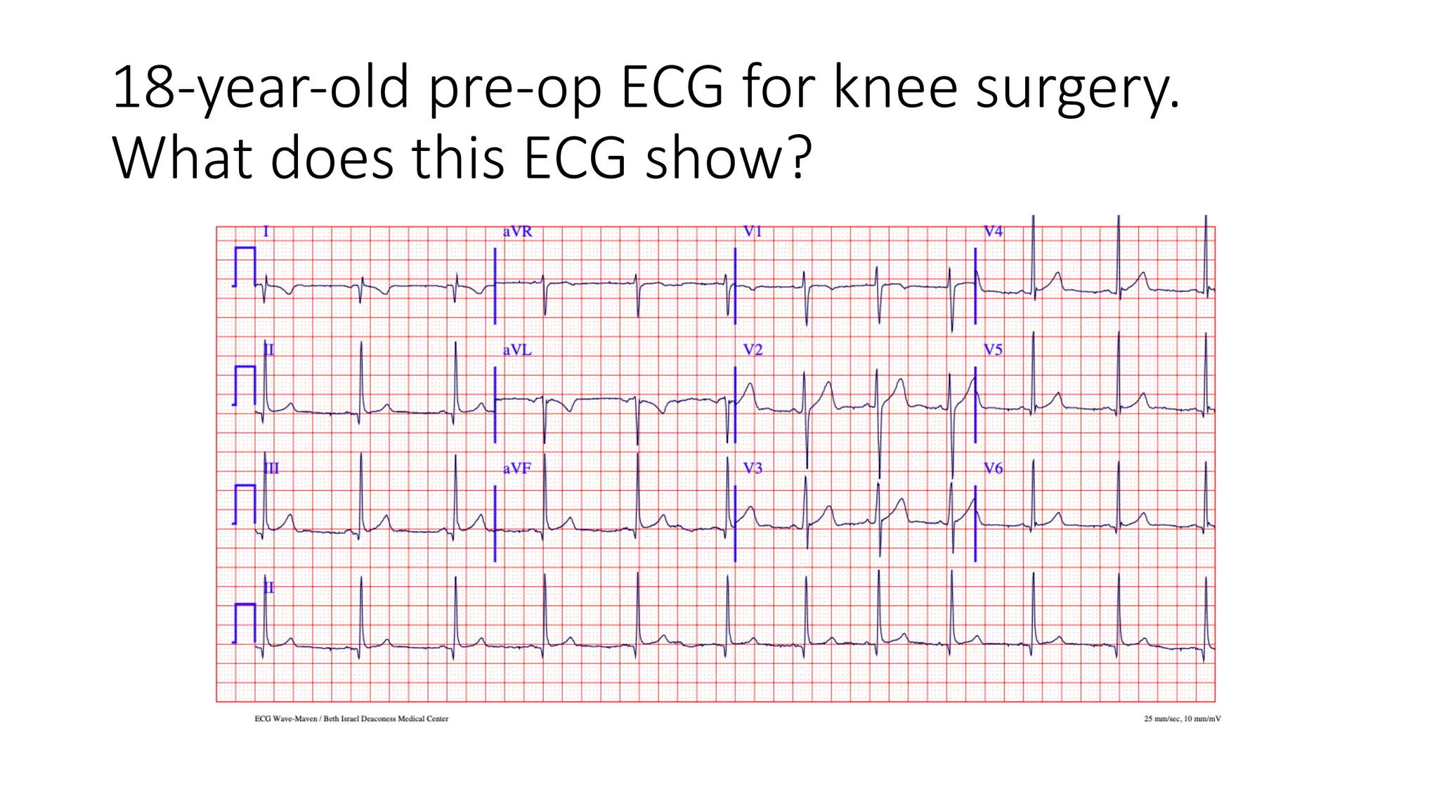 Electrocardiogram (ECG) case studies.pptx