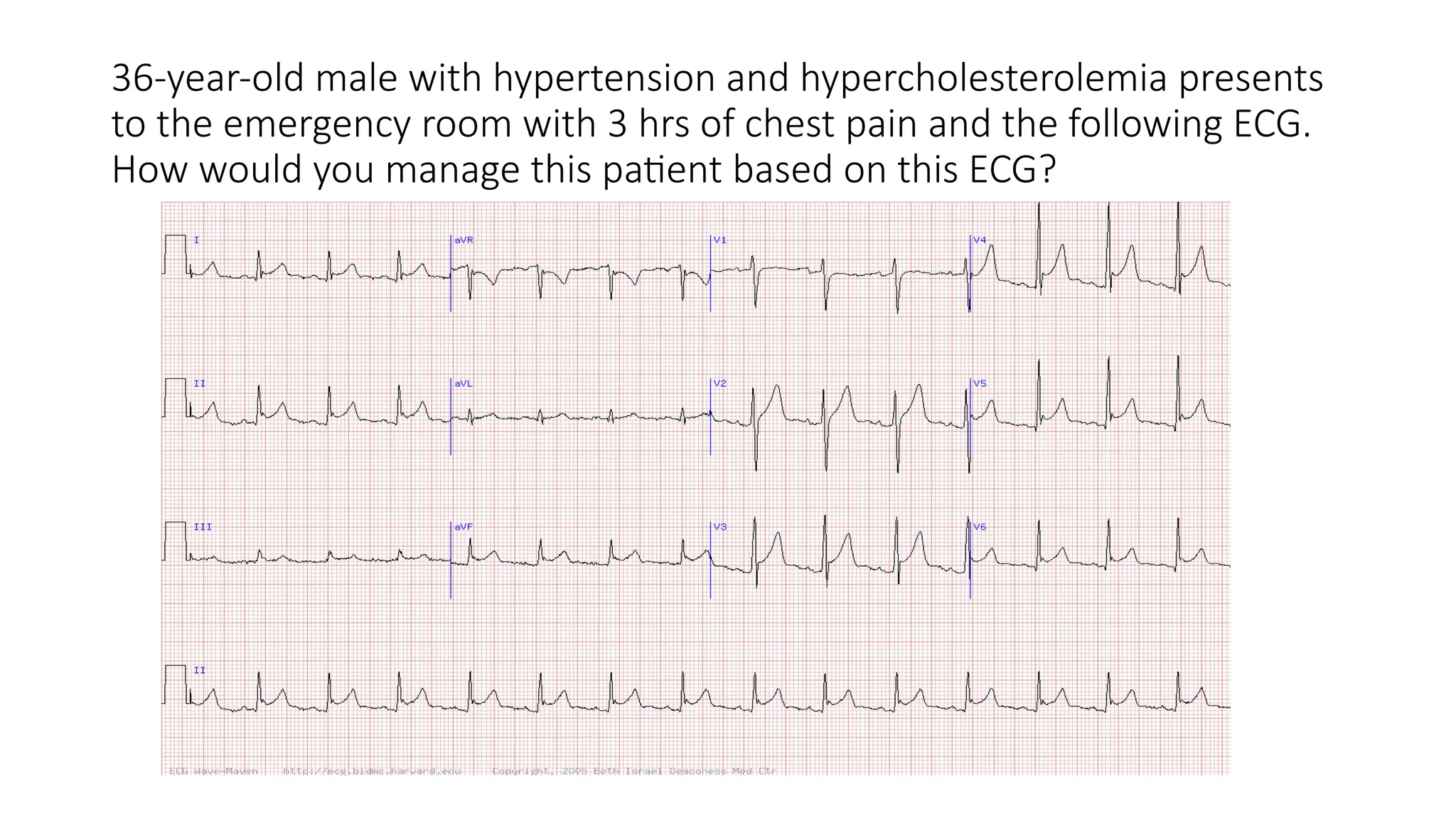 Electrocardiogram (ECG) case studies.pptx