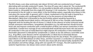 Electrocardiogram (ECG) case studies.pptx