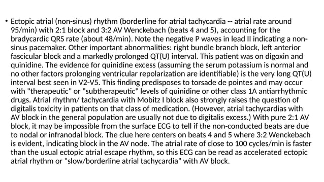 Electrocardiogram (ECG) case studies.pptx