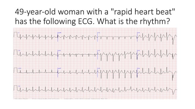 Electrocardiogram (ECG) case studies.pptx