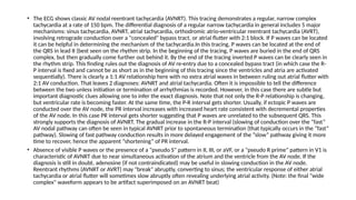 Electrocardiogram (ECG) case studies.pptx