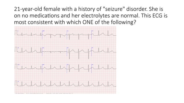 Electrocardiogram (ECG) case studies.pptx