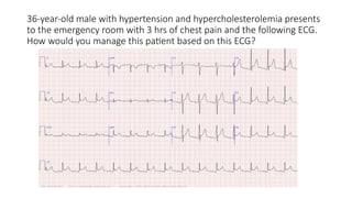 Electrocardiogram (ECG) case studies.pptx