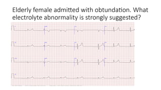 Electrocardiogram (ECG) case studies.pptx