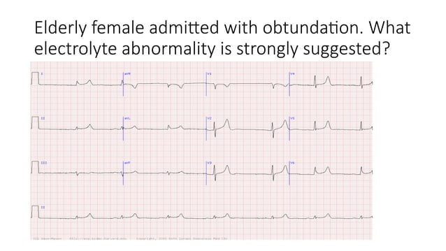 Electrocardiogram (ECG) case studies.pptx