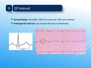 ECG Interpretation for nurses A Step-by-Step Guide to Analyze ECG ...