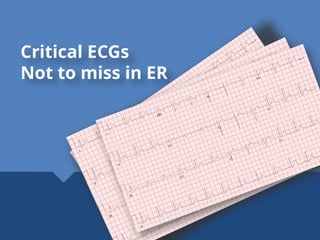 ECG Interpretation for nurses A Step-by-Step Guide to Analyze ECG ...