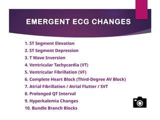 ECG Interpretation for nurses A Step-by-Step Guide to Analyze ECG ...