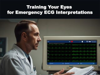 ECG Interpretation for nurses A Step-by-Step Guide to Analyze ECG ...