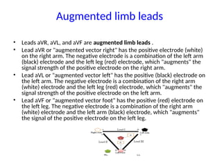 ECG.ppt Electro Cardio Gram.Electro Cardio Gram. | PPT
