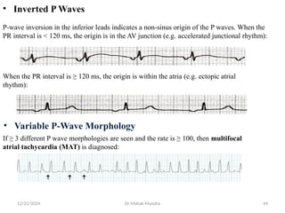 ECG....pptx ECG ALSO KNOWN AS ELECTOCARDIOGRAPHY | PPTX