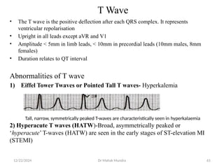 ECG....pptx ECG ALSO KNOWN AS ELECTOCARDIOGRAPHY | PPTX