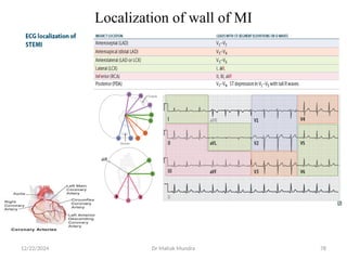 ECG....pptx ECG ALSO KNOWN AS ELECTOCARDIOGRAPHY | PPTX