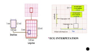 ECG.ppt in this ppt heart rate rhythm, ecg waves all can study | PPT