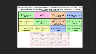 ECG.ppt in this ppt heart rate rhythm, ecg waves all can study | PPT