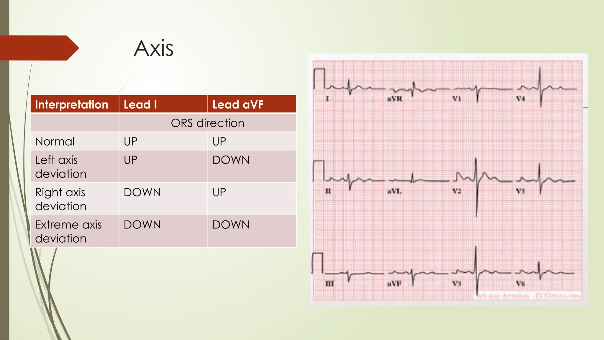 ECG reading and interpretation for beginners.pptx