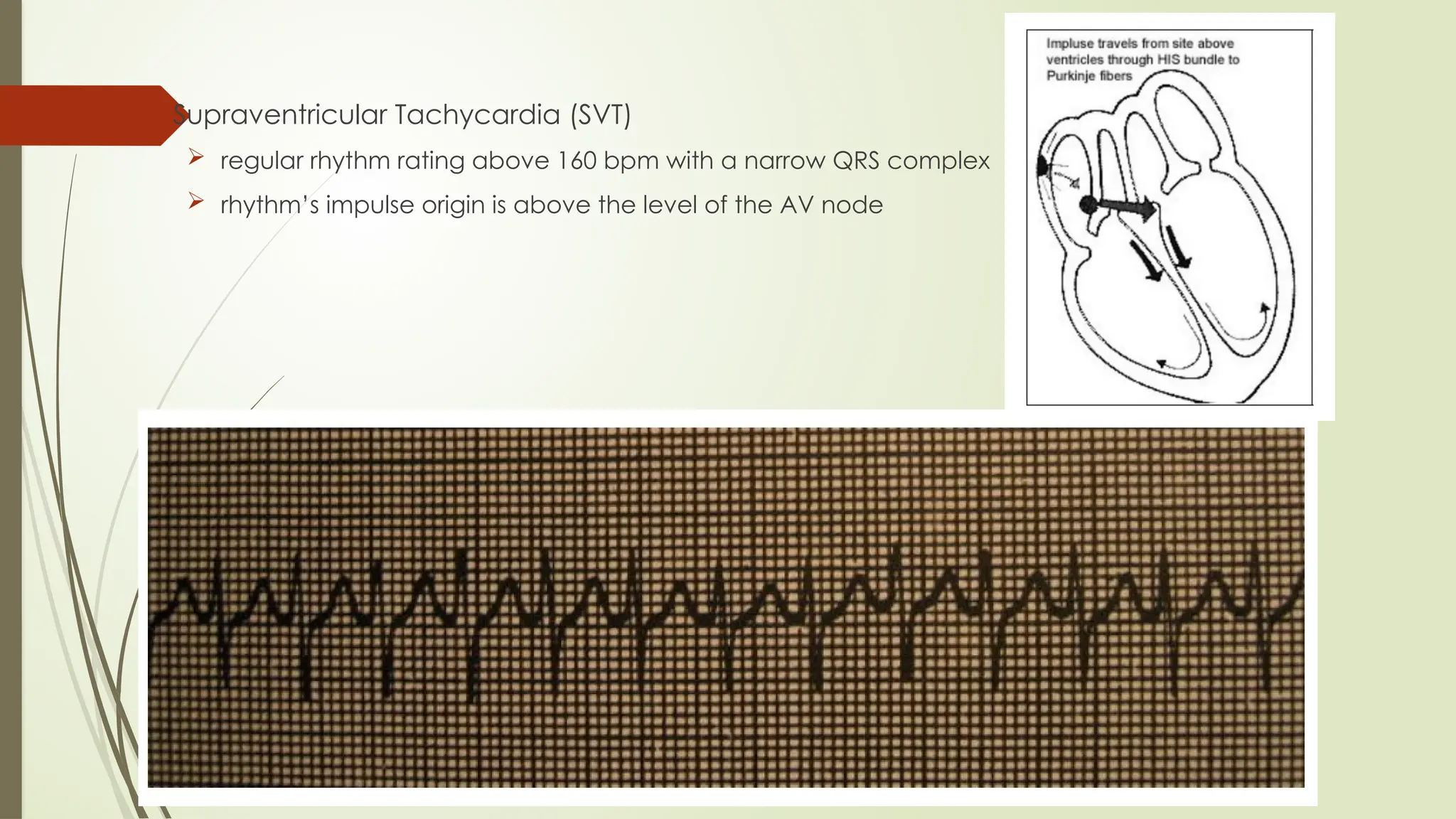 ECG reading and interpretation for beginners.pptx