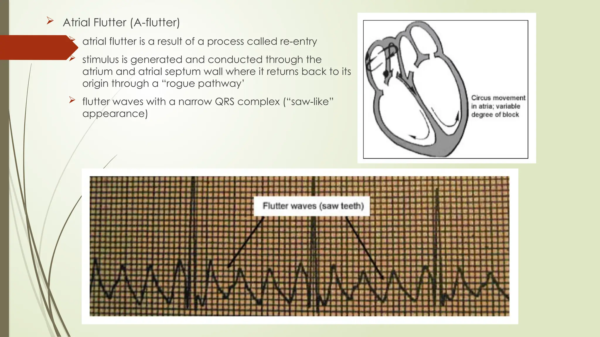 ECG reading and interpretation for beginners.pptx