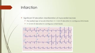 ECG reading and interpretation for beginners.pptx