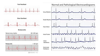 ECG. OR EKG ELECTRO CARDIO GRAPHY .pptx