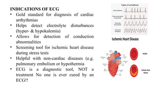 ECG. OR EKG ELECTRO CARDIO GRAPHY .pptx