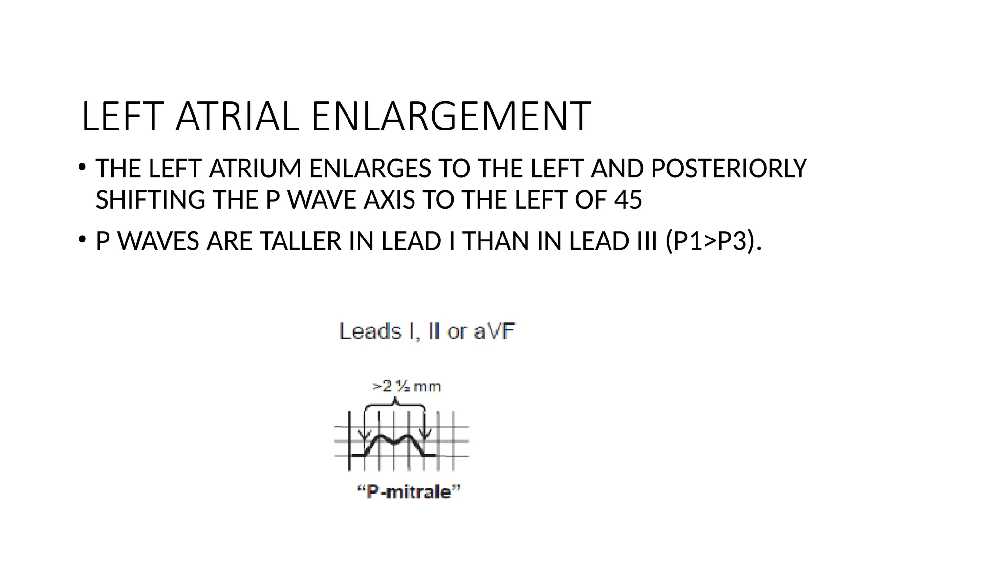 Basics of Ecg interpretation in pediatrics.pptx