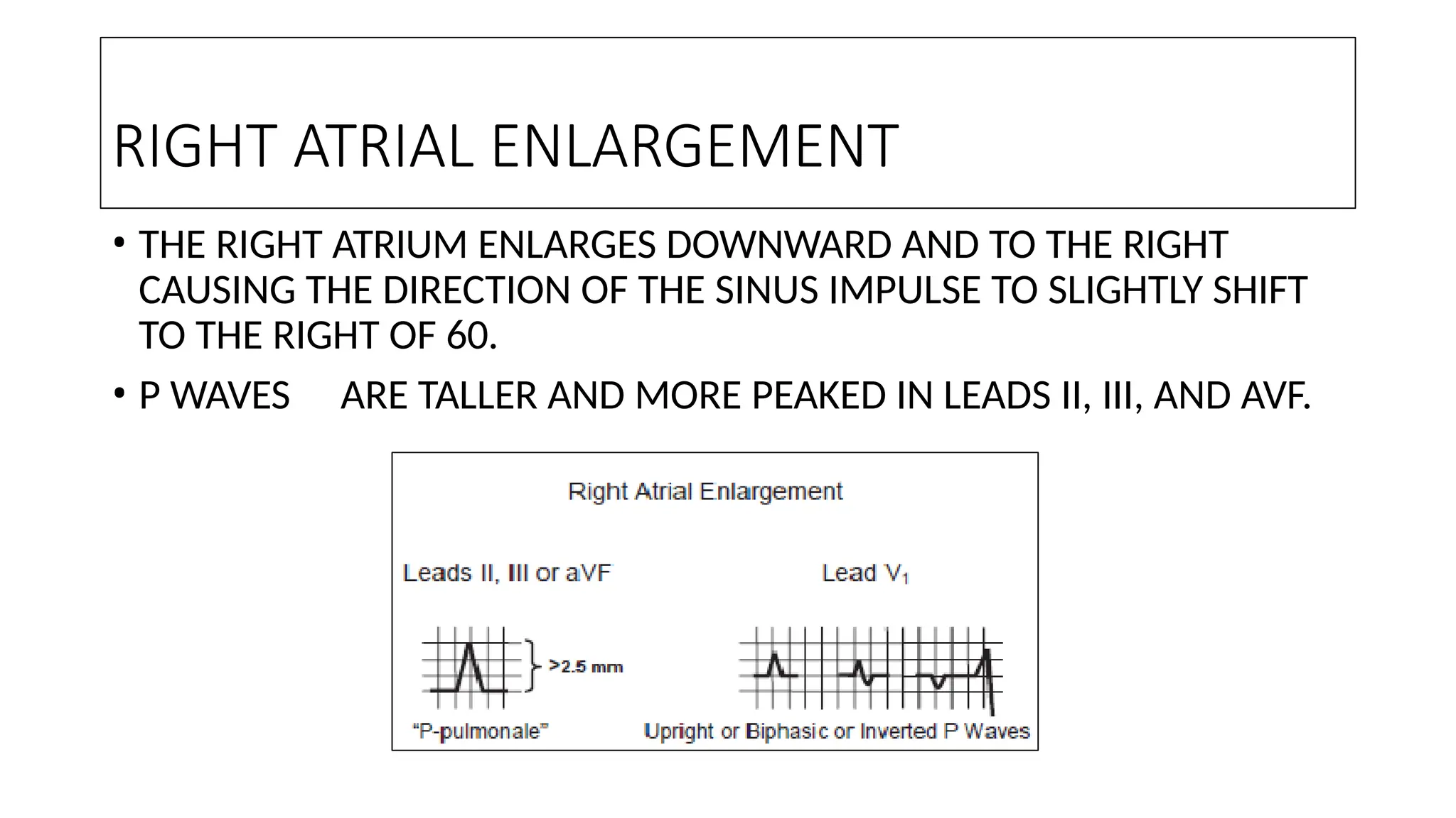 Basics of Ecg interpretation in pediatrics.pptx