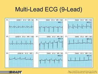 ekg lead placement and aquisition of 12 lead electrocardiogram.pdf