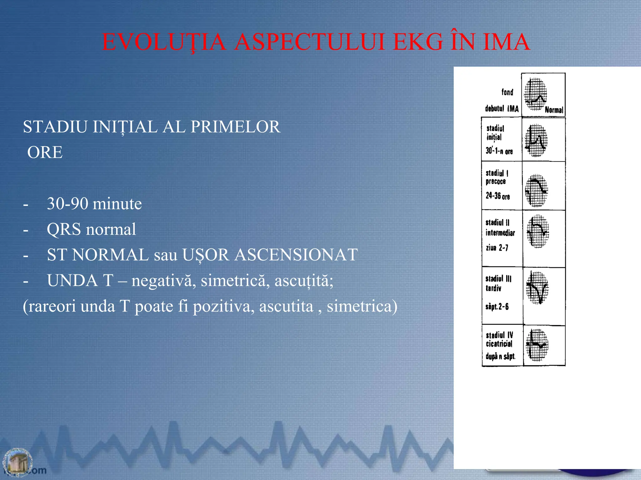 ECG-5-2016-2017-Ischemie-leziune-infacrct.ppt