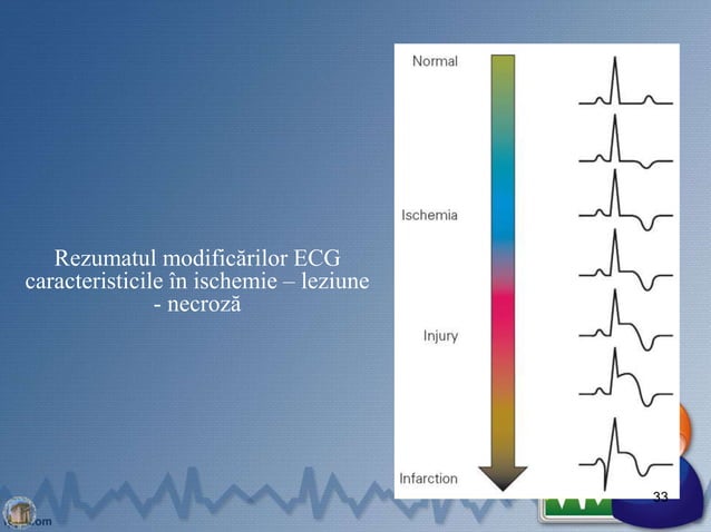 ECG-5-2016-2017-Ischemie-leziune-infacrct.ppt