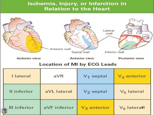 ECG-5-2016-2017-Ischemie-leziune-infacrct.ppt