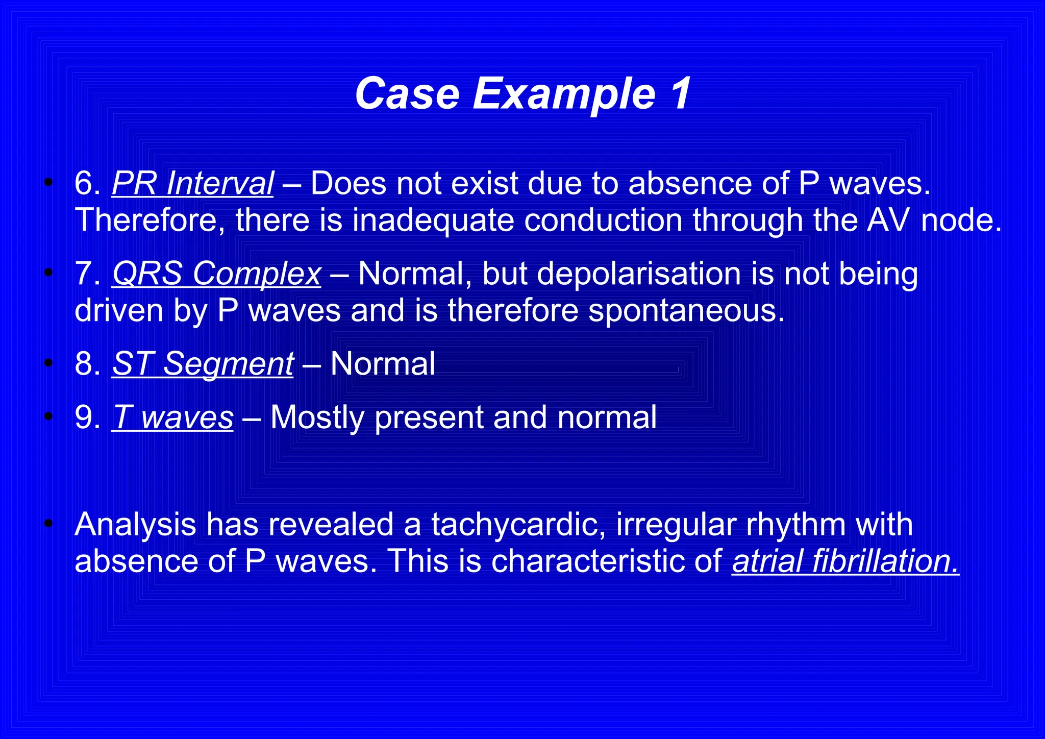 Ecg Analysis Ppt Interpretation Of Electrocardiogram Ppt