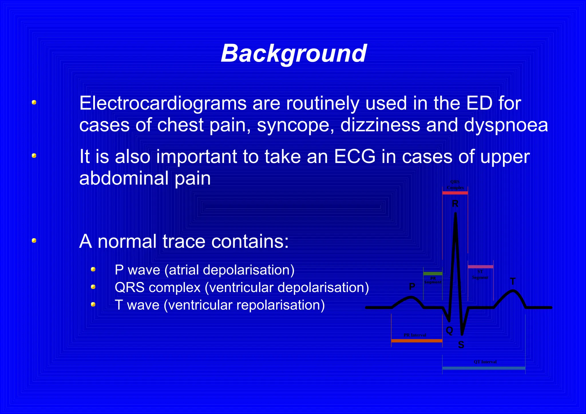 ECG-Analysis.ppt interpretation of electrocardiogram | PPT