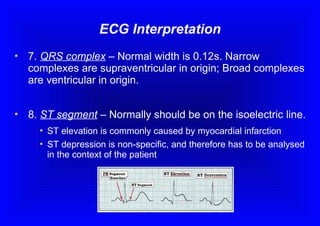 ECG-Analysis.ppt interpretation of electrocardiogram | PPT
