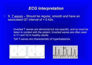 ECG-Analysis.ppt interpretation of electrocardiogram | PPT