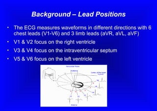 ECG-Analysis.ppt interpretation of electrocardiogram | PPT