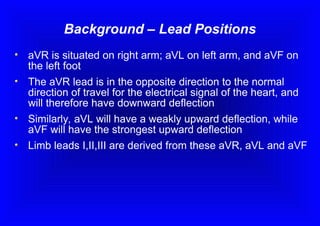 ECG-Analysis.ppt interpretation of electrocardiogram | PPT