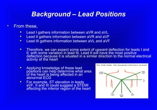 ECG-Analysis.ppt interpretation of electrocardiogram | PPT