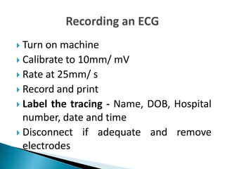 ECG | PPTX