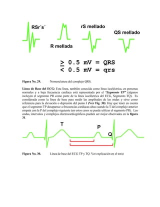 Electrocardiograma_ principios básicos para la interpretación | PDF