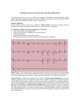 Electrocardiograma_ principios básicos para la interpretación | PDF
