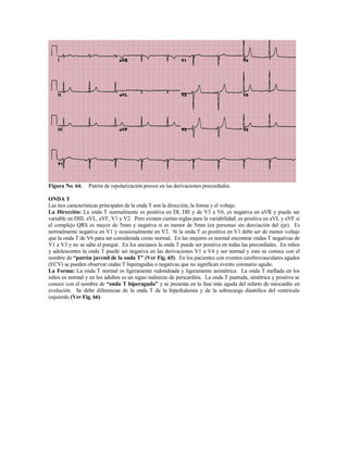 Electrocardiograma_ principios básicos para la interpretación | PDF