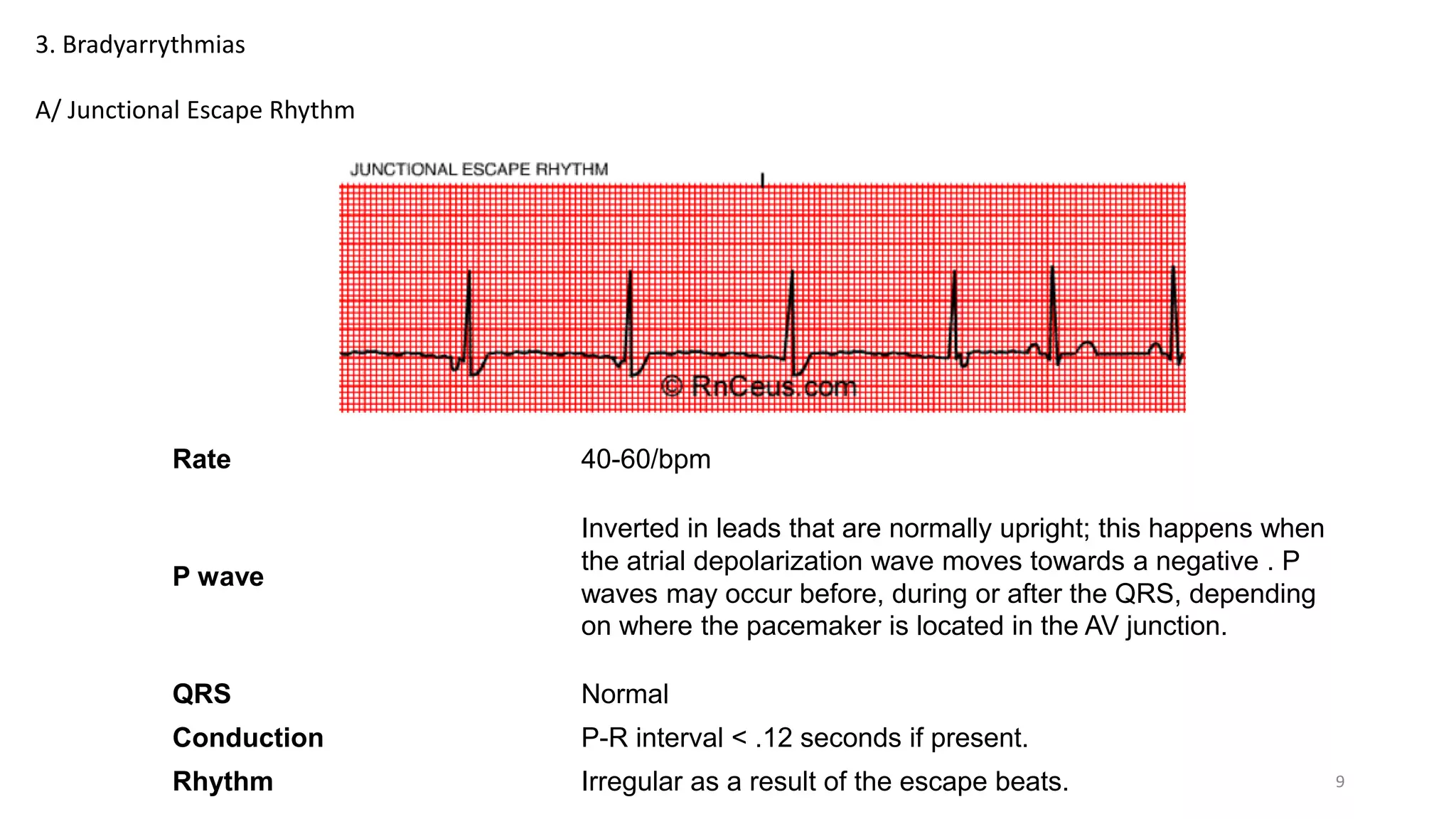 ECG-cases.pptx