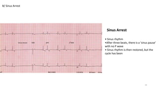 ECG-cases.pptx